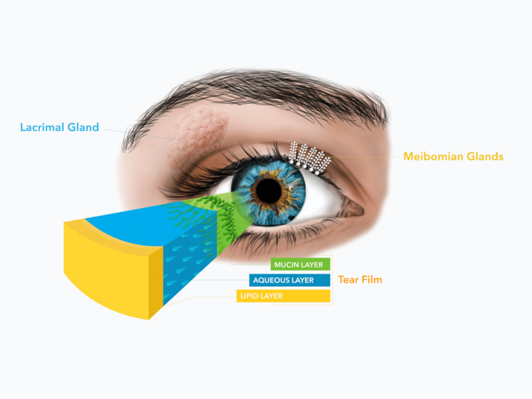 Dry Eye Memphis Dry Eye Treatment Southaven Eye Specialty Group Dry Eye Memphis Dry Eye Treatment Southaven Eye Specialty Group